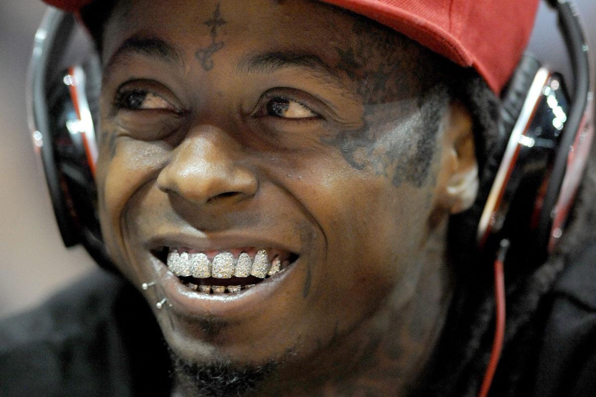 Il grillz: una moda poco salutare per i denti. - Dott. Savino Cefola